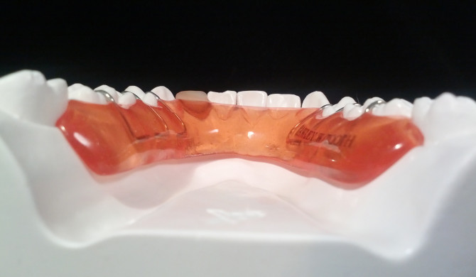 Hawley Retainer With Teeth @ OrthoPrime