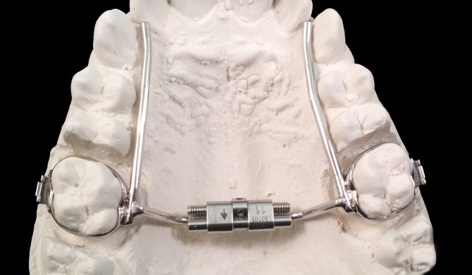 Compact RPE Upper @ OrthoPrime